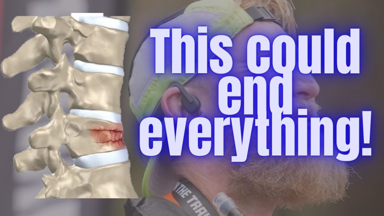 I HAVE BROKEN MY BACK - YouTube