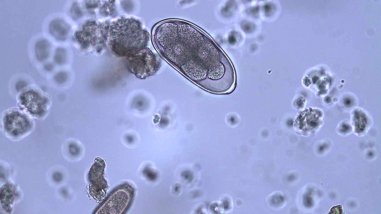 Syngamus trachea and Capillaria sp. (avian faecal sample) What a ...