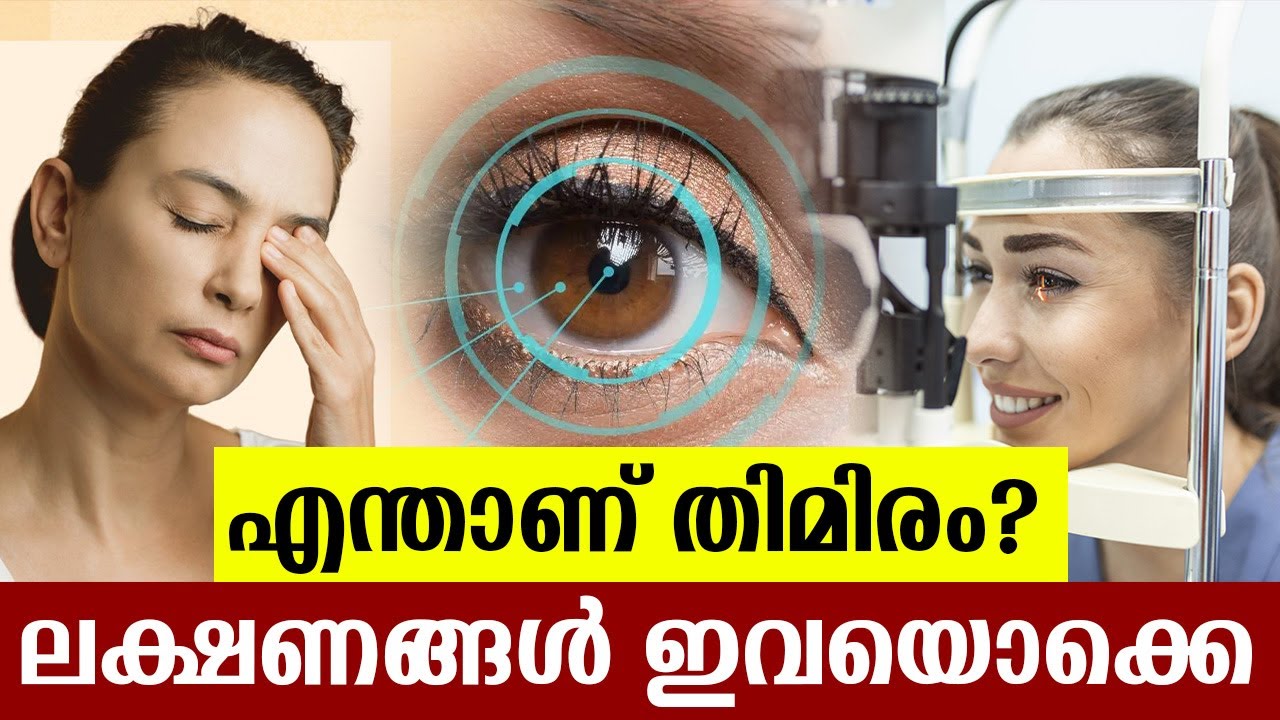 തിമിരം- കാരണവും ലക്ഷണങ്ങളും | cataract- Causes and symptoms - YouTube