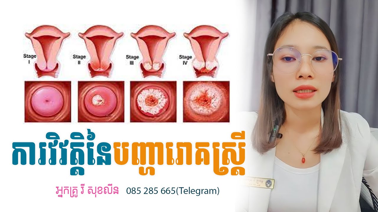 ការពីវិវត្តនៃបញ្ហារោគស្ត្រី 085285665 (Telegram) - YouTube
