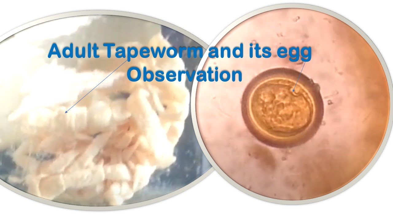 What Do Tapeworm Eggs Look Like In Human Stool