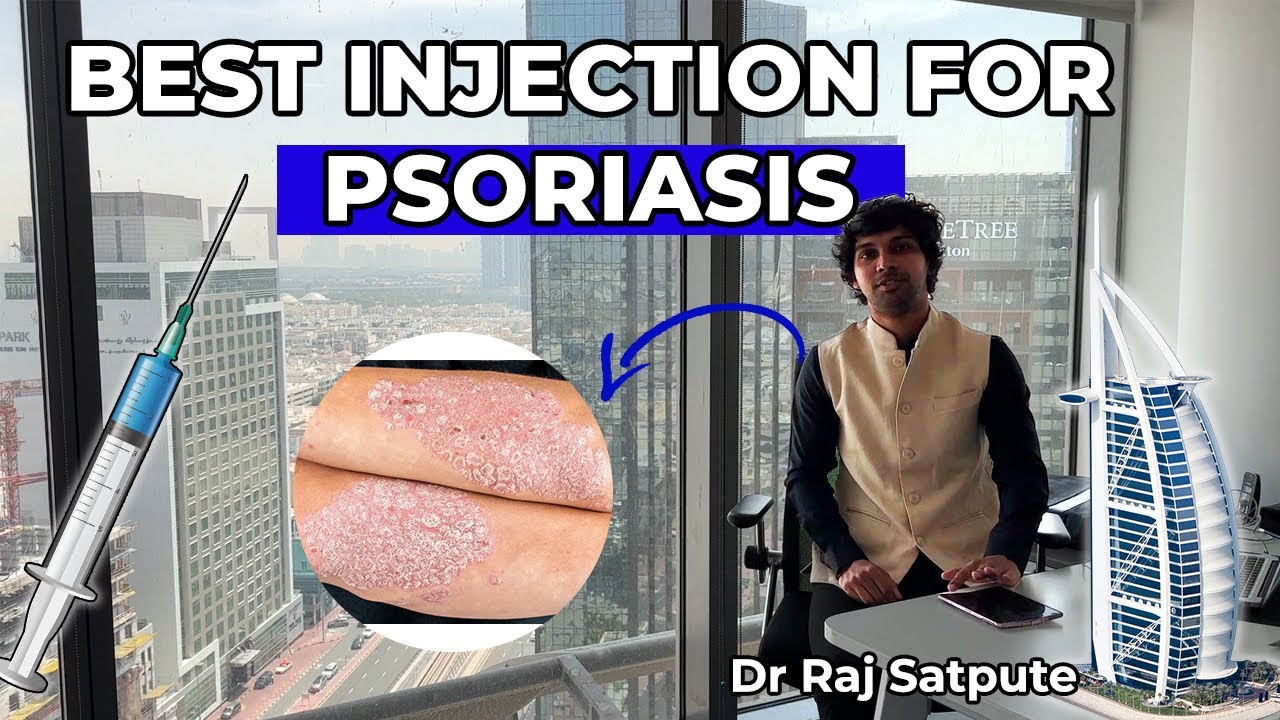 Best Injection For Psoriasis | DUBAI | Long Term Benefits! - YouTube