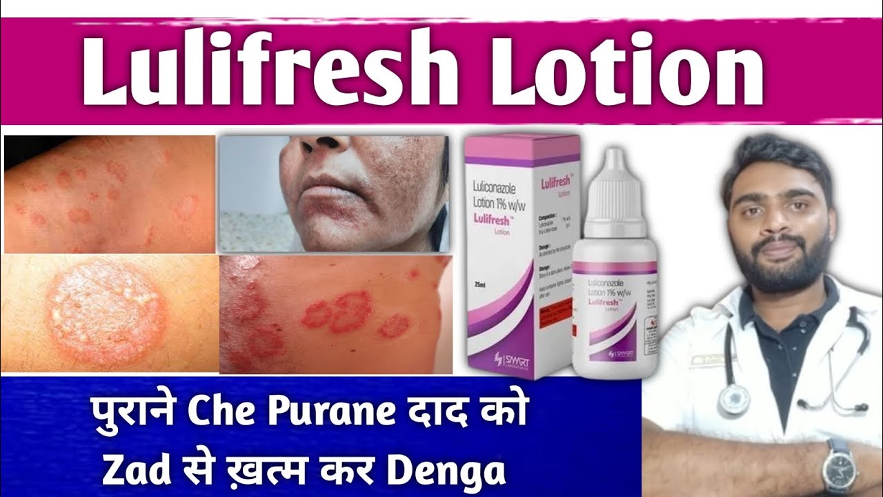 Lulifresh Lotion | Luliconazol Lotion Uses | Dose | Side Effects ...