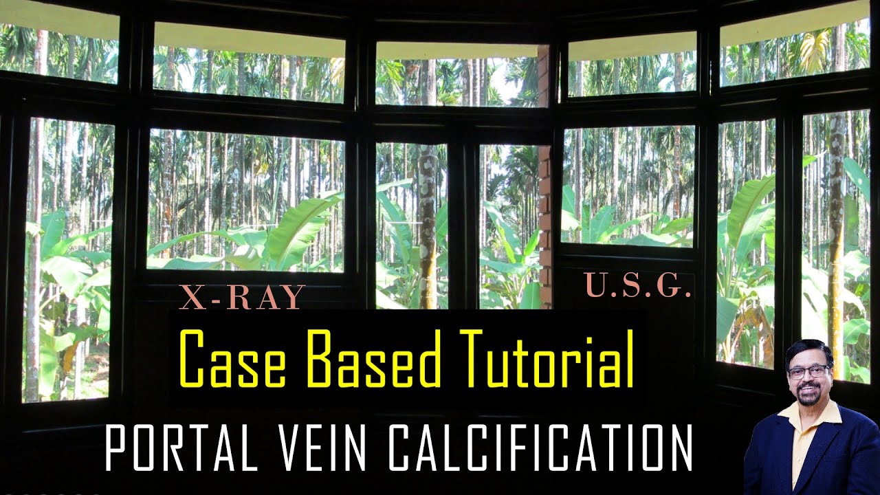 PORTAL VEIN CALCIFICATION (X-RAY & U.S.G.) - A CASE BASED TUTORIAL ...