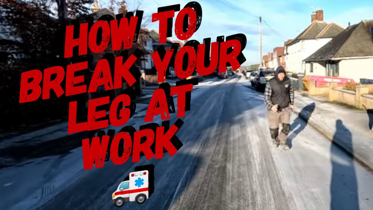 How to break your leg at work #079 - YouTube
