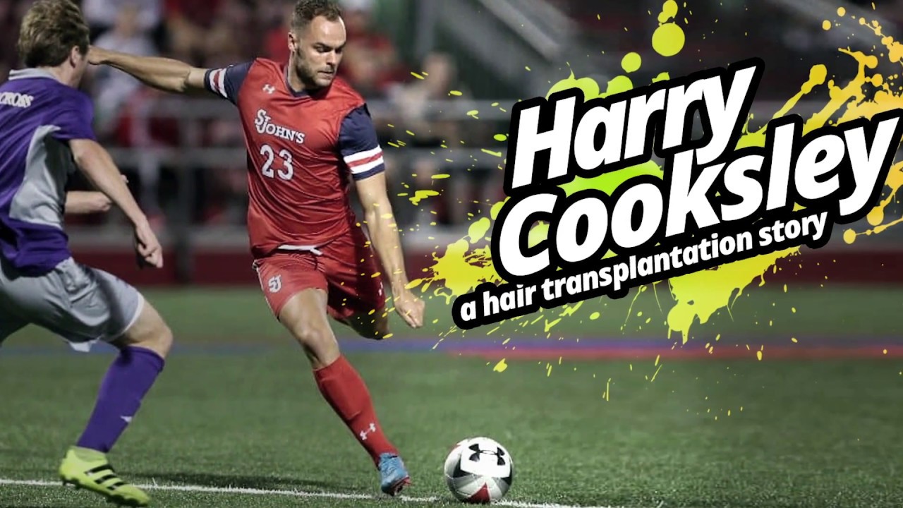 HARRY COOKSLEY | HAIR TRANSPLANTATION TURKEY | ESTEPERA HAIR CLINIC ...