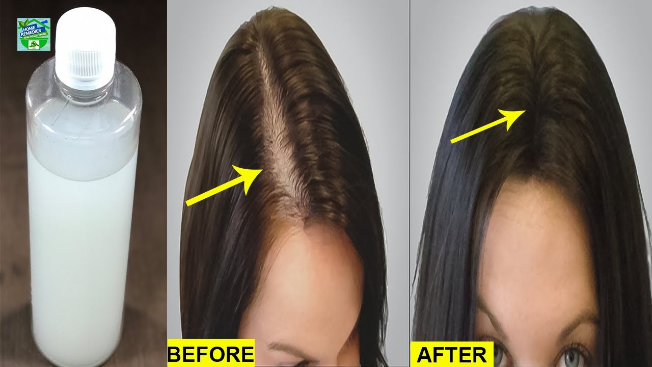 How You Should Use Rice Water For Extreme Hair Growth Youtube