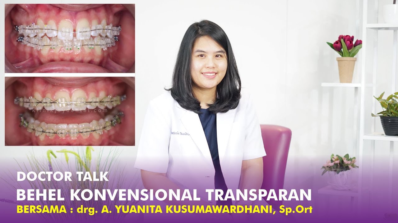 Jenis Behel - Behel Konvensional Transparan - Behel Gigi Bening yang ...