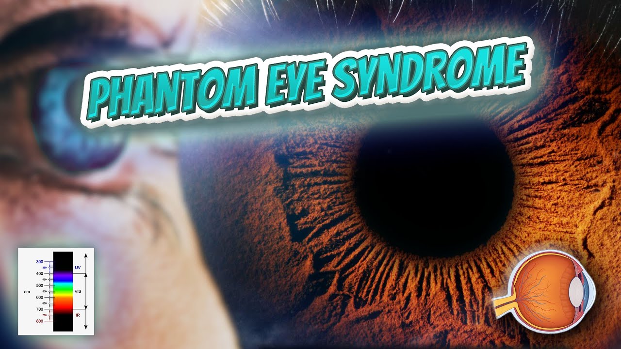 Phantom eye syndrome - Your EYEBALLS - EYNTK 👁️👁️💉😳💊🔊💯 - YouTube