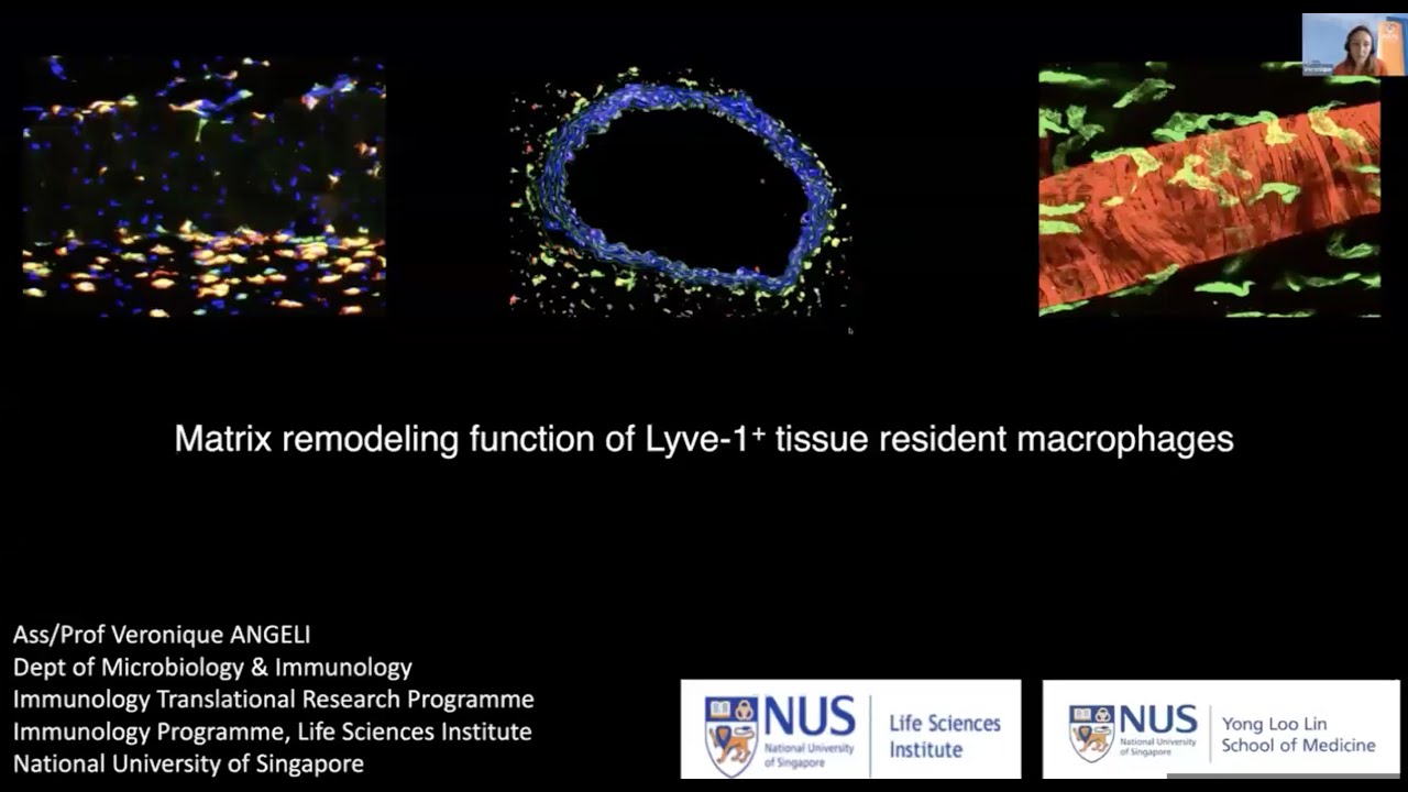 "Matrix remodeling function of Lyve-1+ tissue resident macrophages" by ...