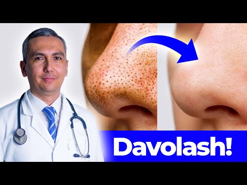 Burundagi Qora Nuqtalarni oson davolash!