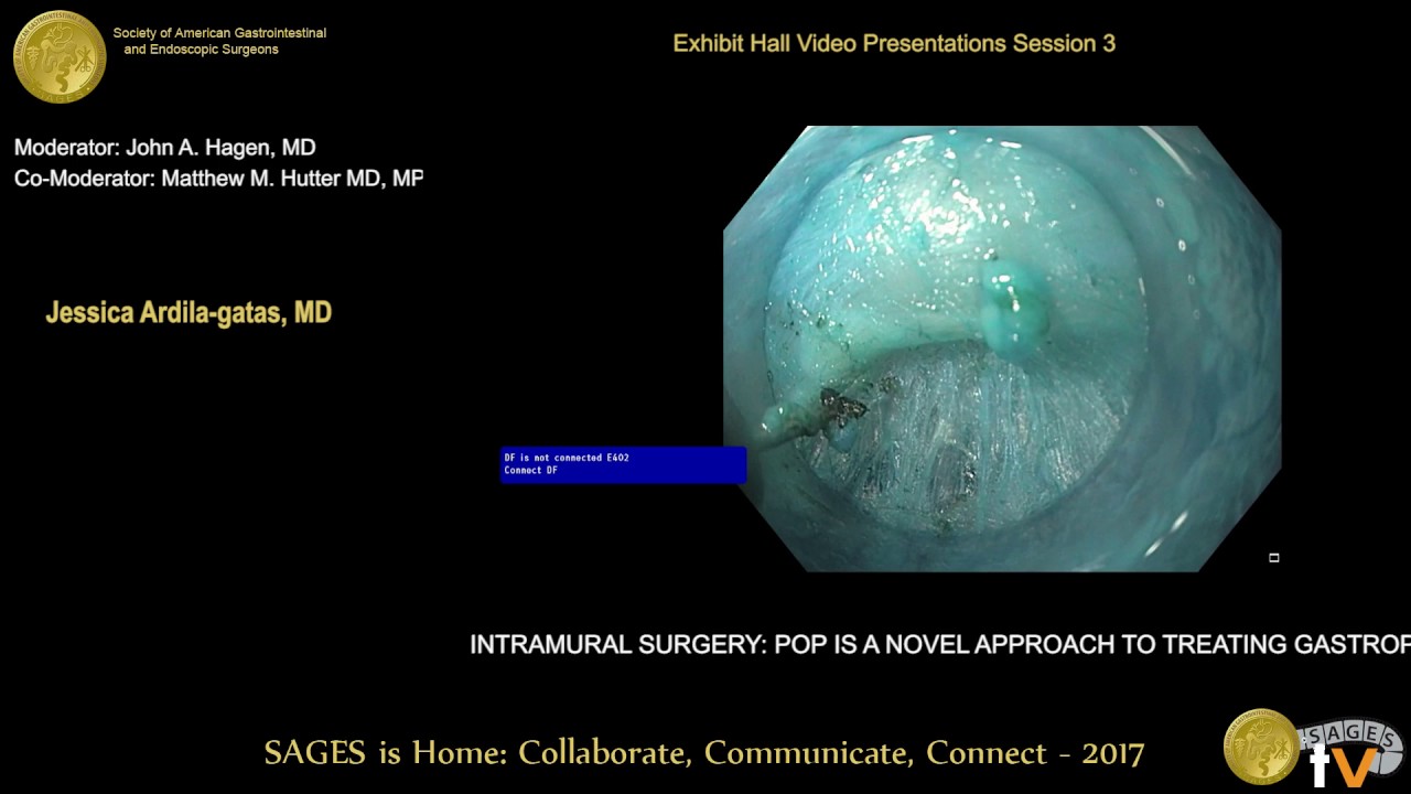 Intramural surgery: POP is a novel approach to treating gastroparesis ...