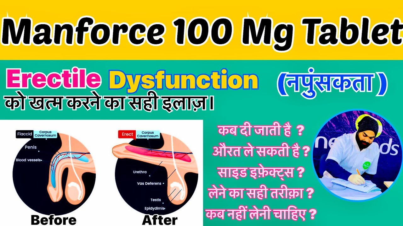 Manforce 100 Mg Tablet की फुल इन्फ़ॉर्मेशन Erectile Dysfunction ...
