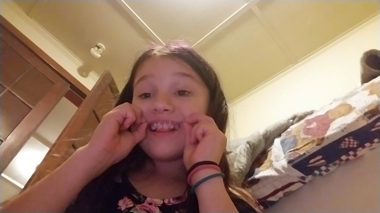 How to make fake braces - YouTube