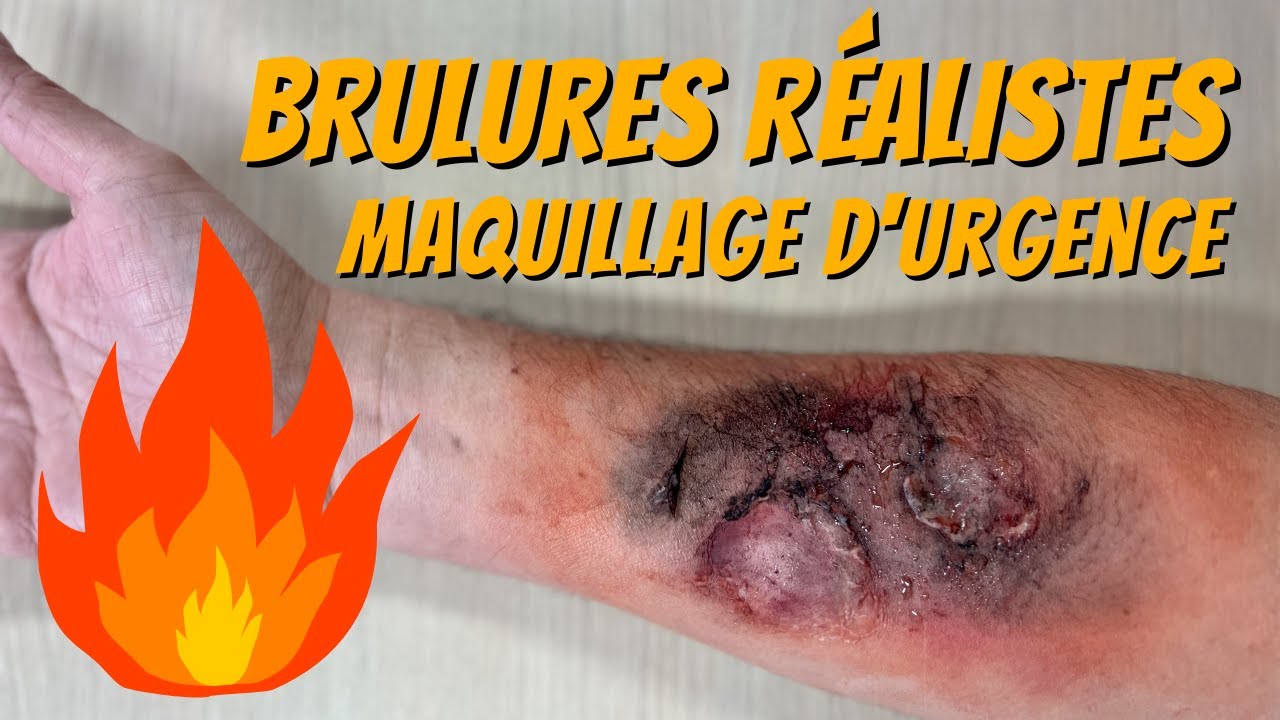 TUTO DÉBUTANT : CRÉER des BRULURES RÉALISTES ÉPOUSTOUFLANTES ! - YouTube