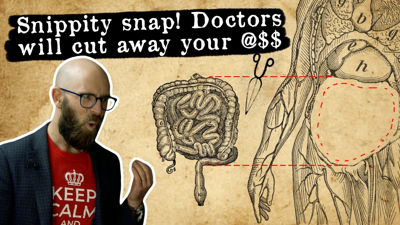 Removing Butts: The Bizarre Early 20th Century Obsession with Removing ...