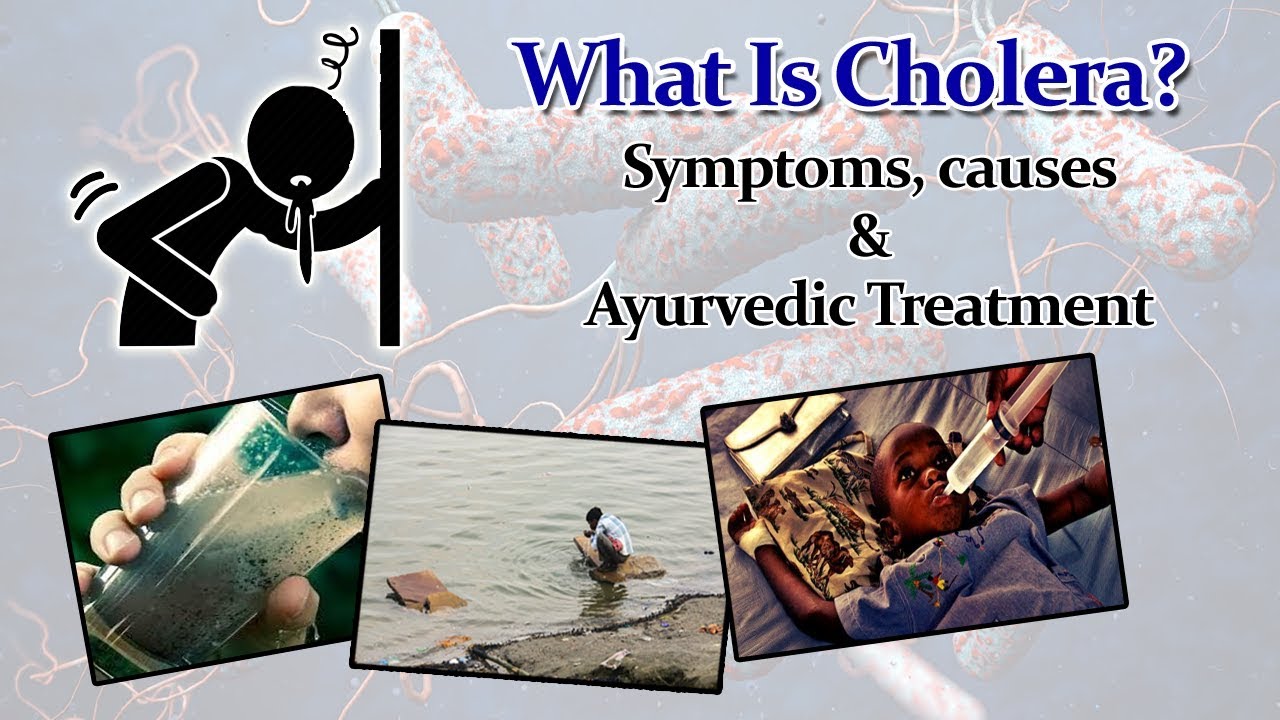 How Cholera Affects Your Body? Symptoms, Causes and Ayurvedic Treatment ...