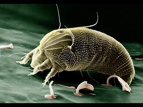 Comment lutter naturellement contre les acariens - YouTube