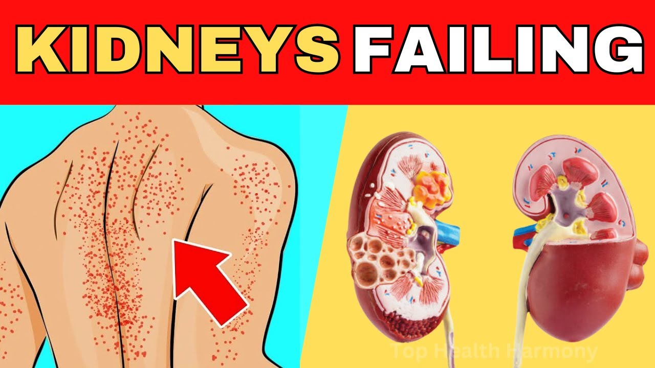 8 Warning Signs Your Kidneys Need IMMEDIATE Attention! - YouTube