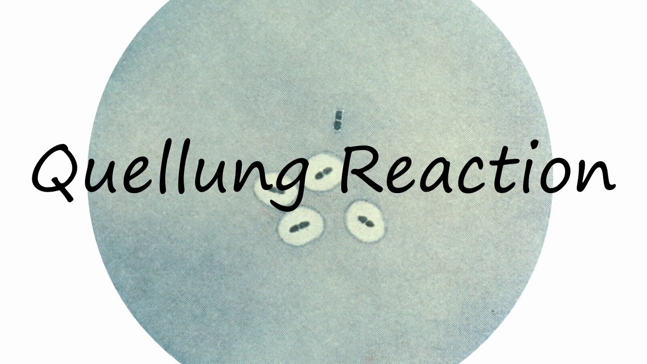 How to Pronounce Quellung Reaction? - YouTube