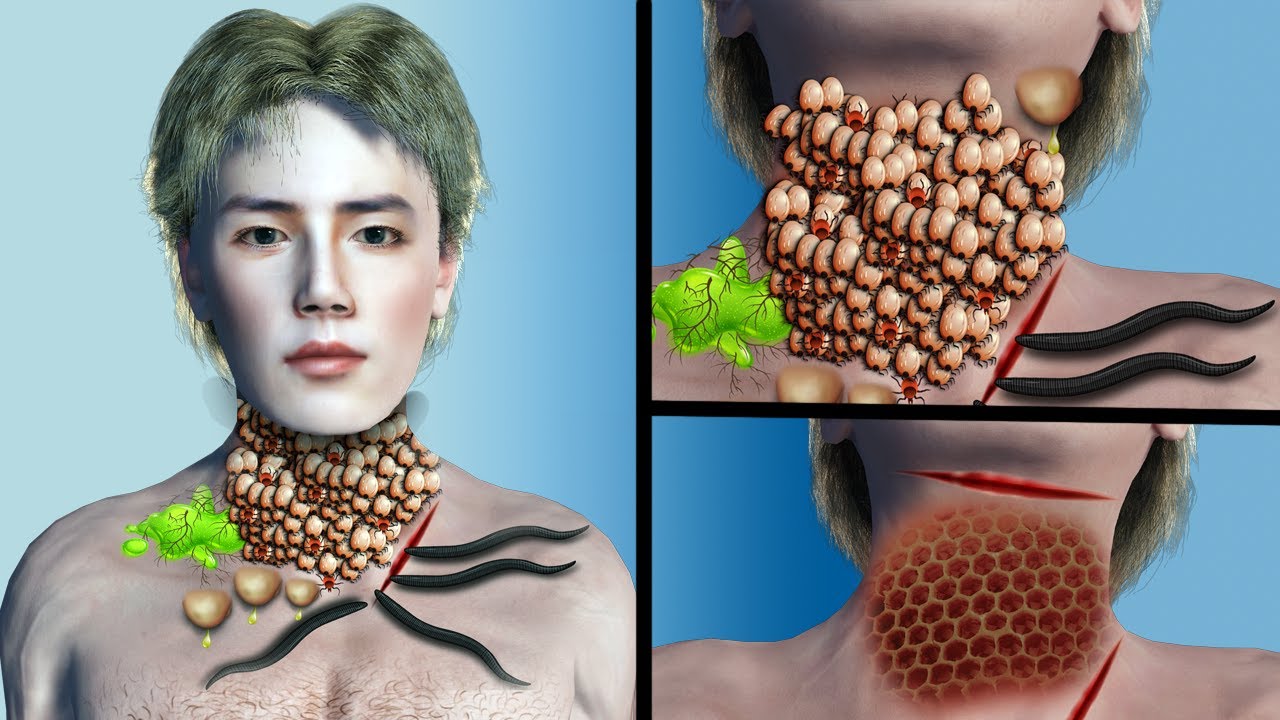 ASMR Removal Maggot Infected & Dog Ticks | Severely Injured Animation ...