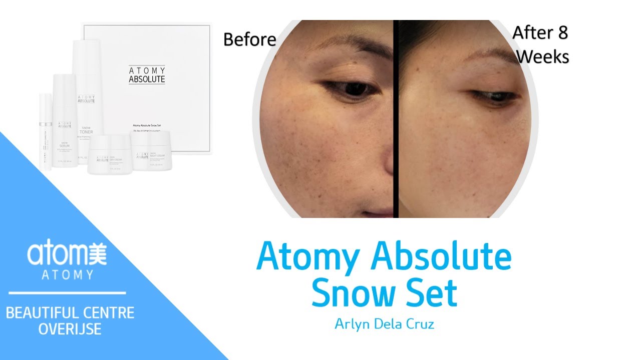 ATOMY ABSOLUTE SNOW SET BY ARLYN DELA CRUZ | ARJOYCE DUMORTIER - YouTube