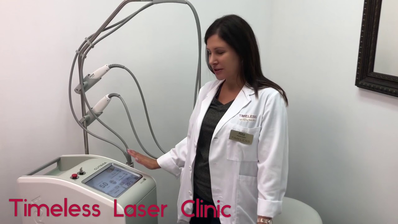 Cutera Excel V demo, skin laser treatment - YouTube