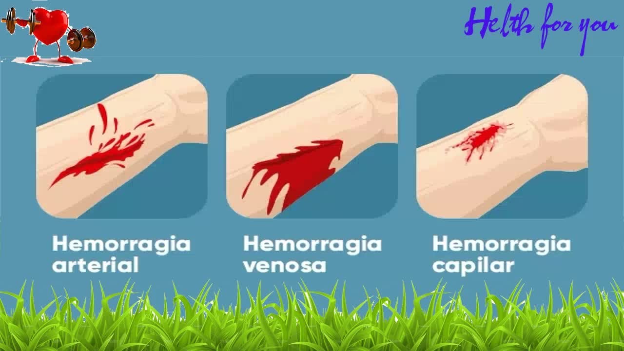 Saúde - Como identificar e tratar os diferentes tipos de Hemorragia ...