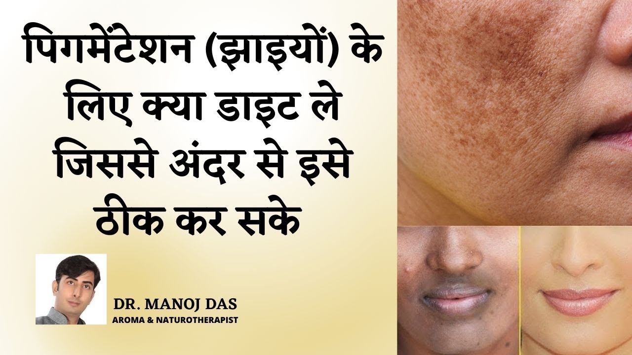 Diet to Reduce Skin Pigmentation I झाइयों को कम करने के लिए क्या खाये ...