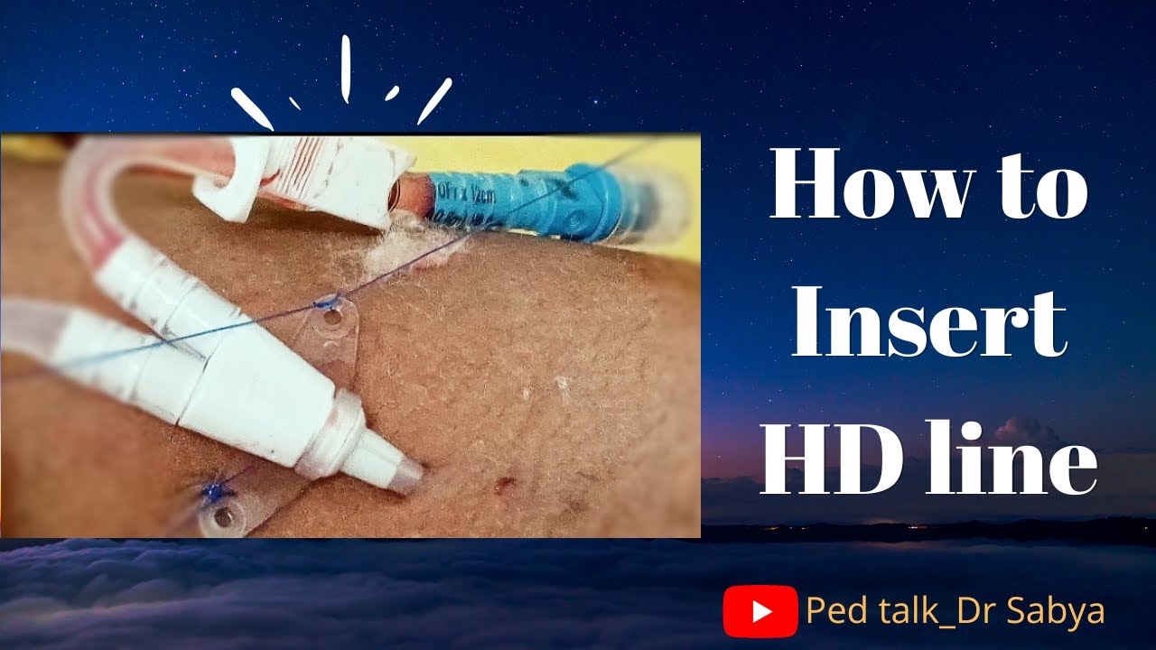 Insertion of HD line/ Hemodialysis line/ Plasma exchange line/ #DrSabya ...