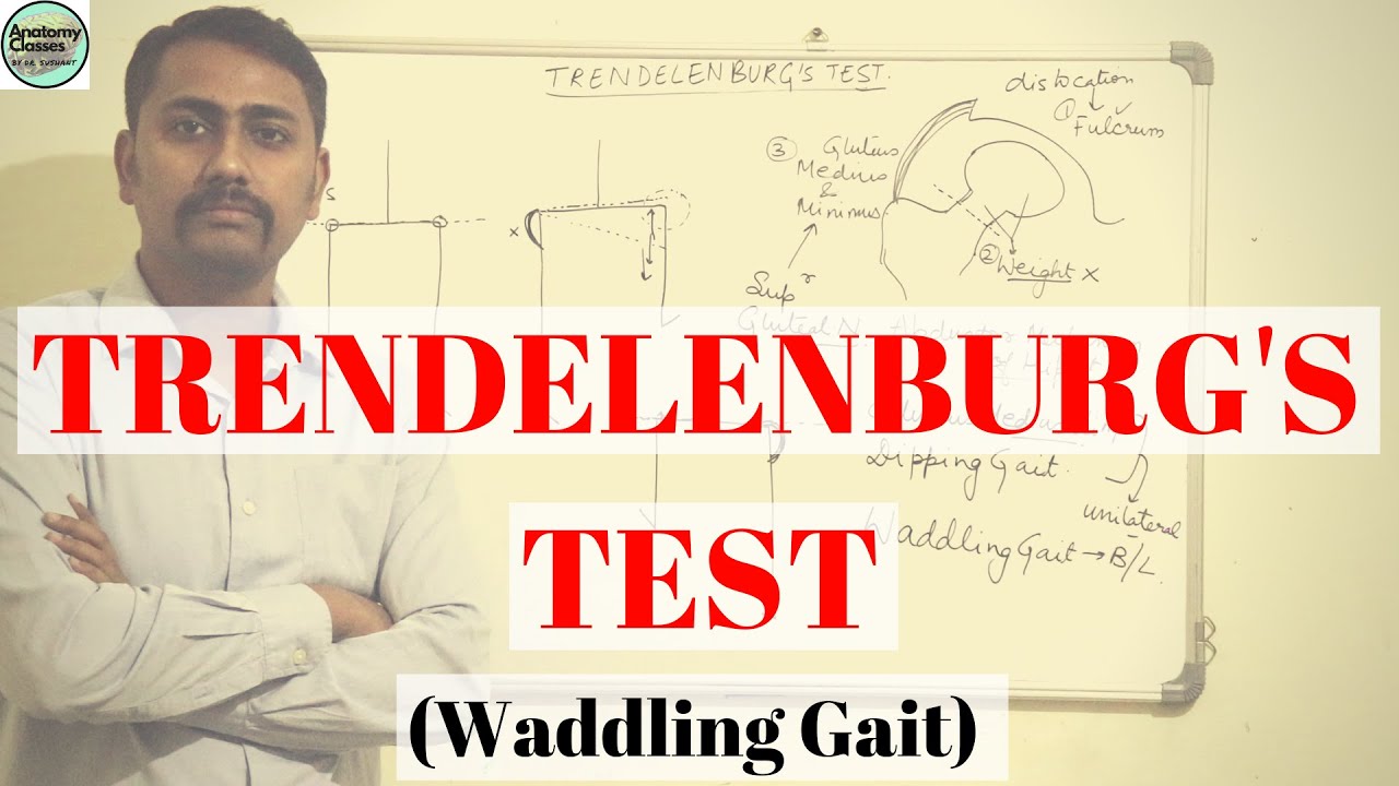 Trendelenburg's Test I Waddling Gait - YouTube