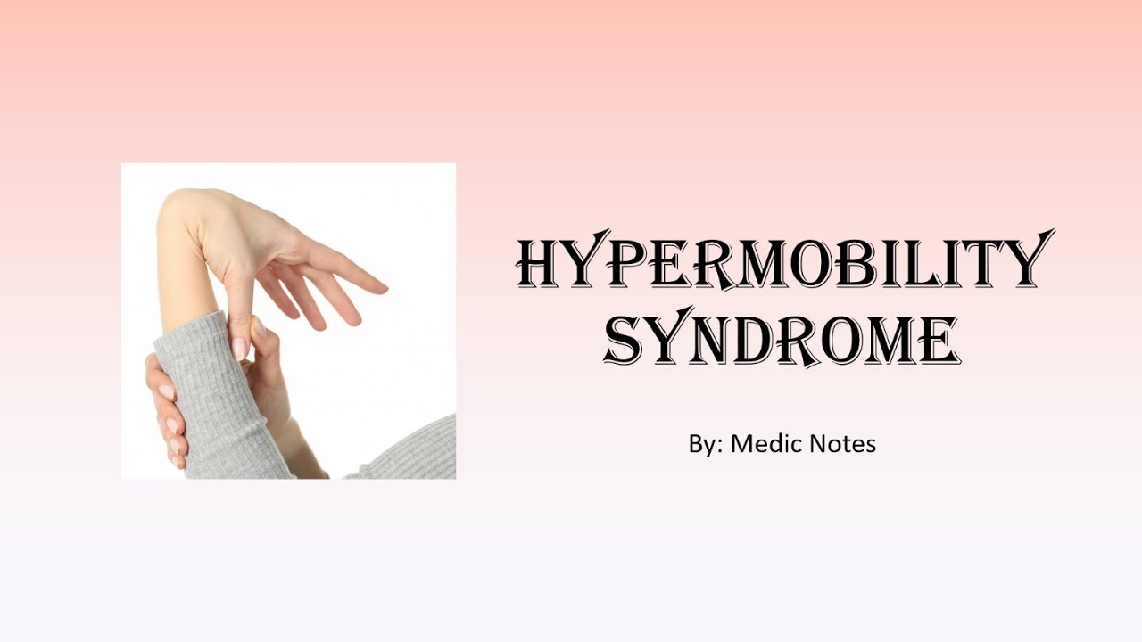 Hypermobility Syndrome Signs And Symptoms Investigations Diagnostic
