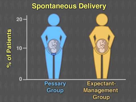 Cervical Pessary to Prevent Preterm Birth? | NEJM