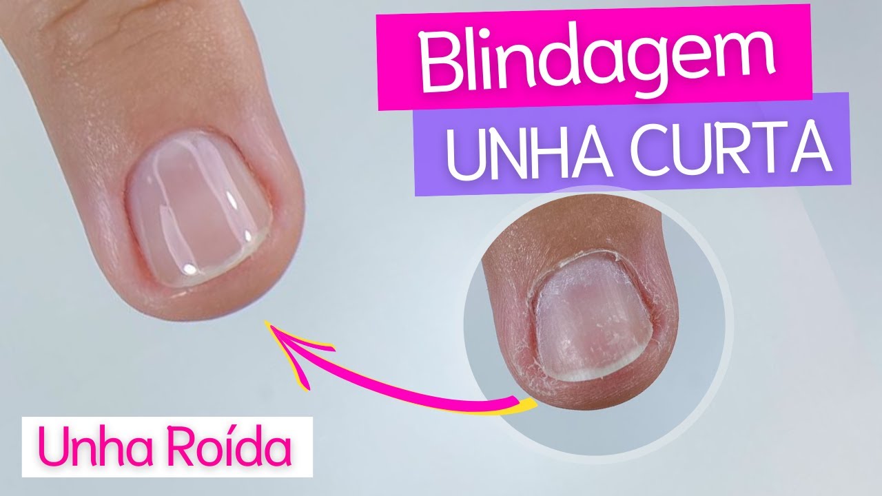 Blindagem Unha Curta e Roída | Mundo Nails - YouTube