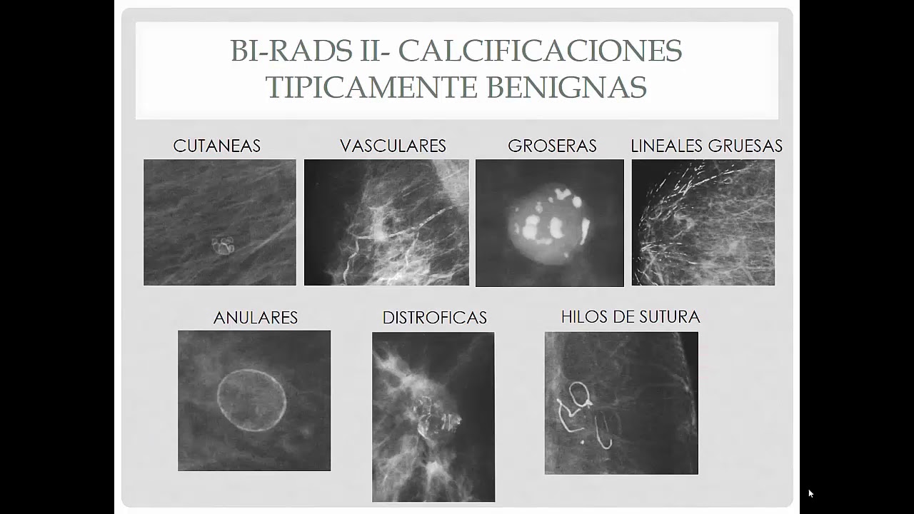 Bi Rads Eco Mx - YouTube