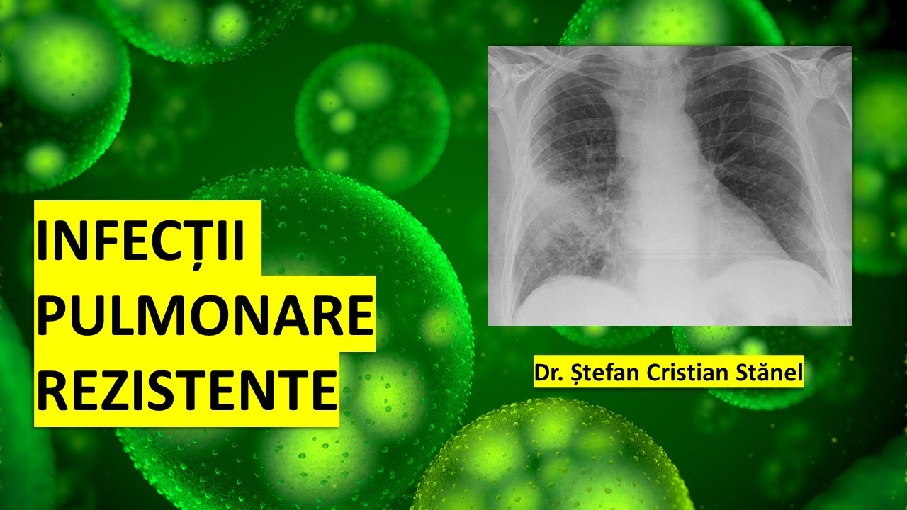 Infectii pulmonare cu bacterii foarte rezistente (ex. Serratia) - YouTube