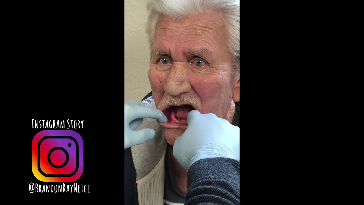 Thanksgiving is here and Grandpa needs new dentures. (super exciting ...