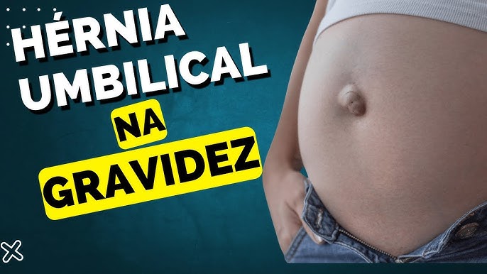 Hernia Umbilical Apos Gravidez