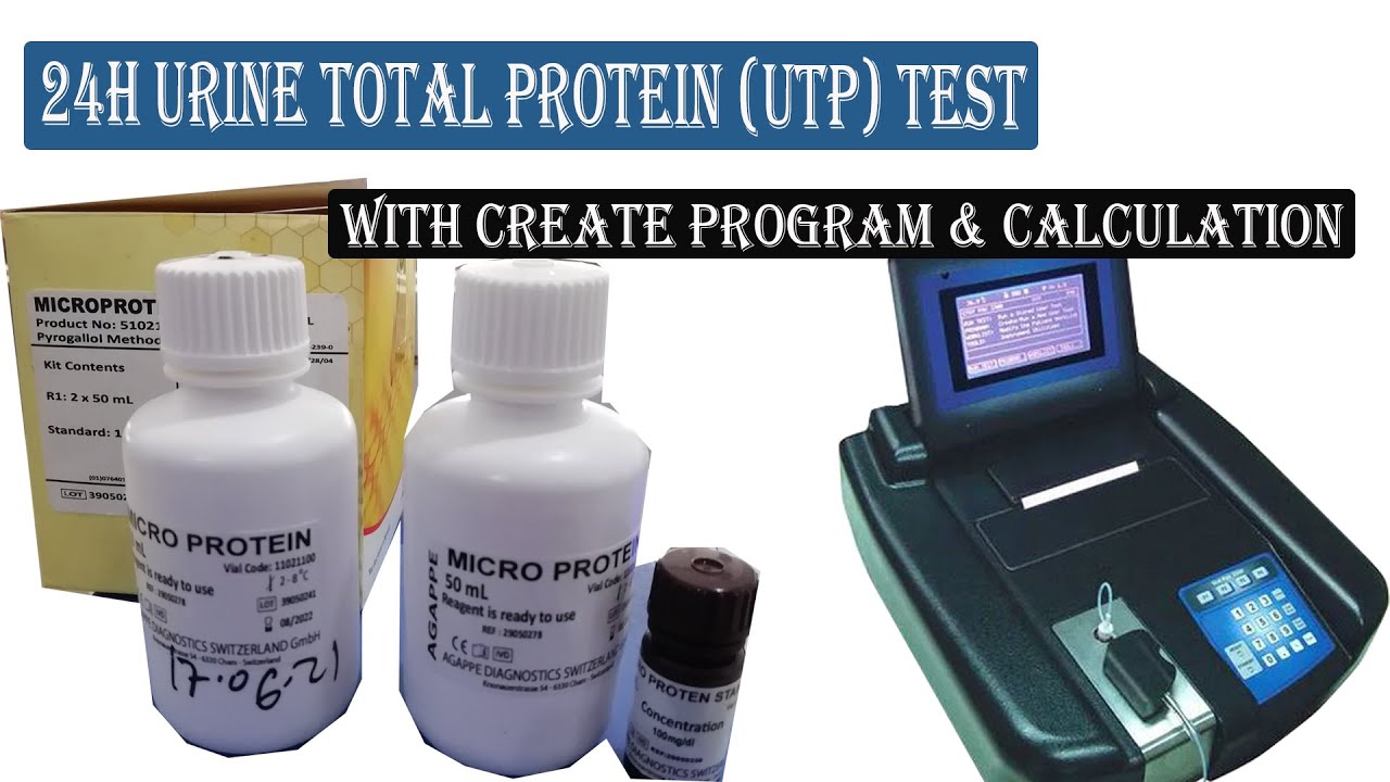 24 Hour Urine Protein Test Procedure Program 