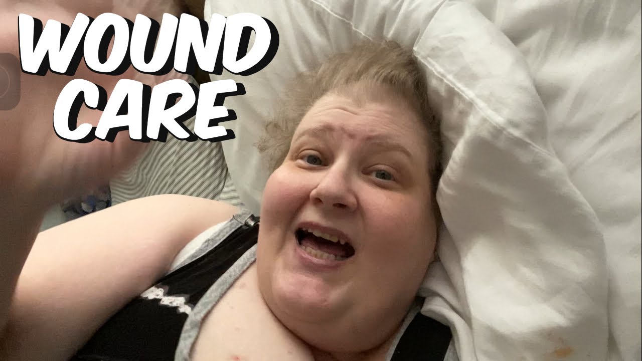 Wound Care- Post Immunotherapy Rash & Post Chemotherapy-Post Surgical ...