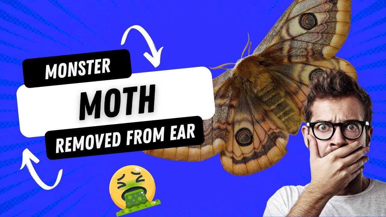 Living Moth Removed From Ear! My Worst Nightmare! 🦋👂 = 🤢 #gross # ...