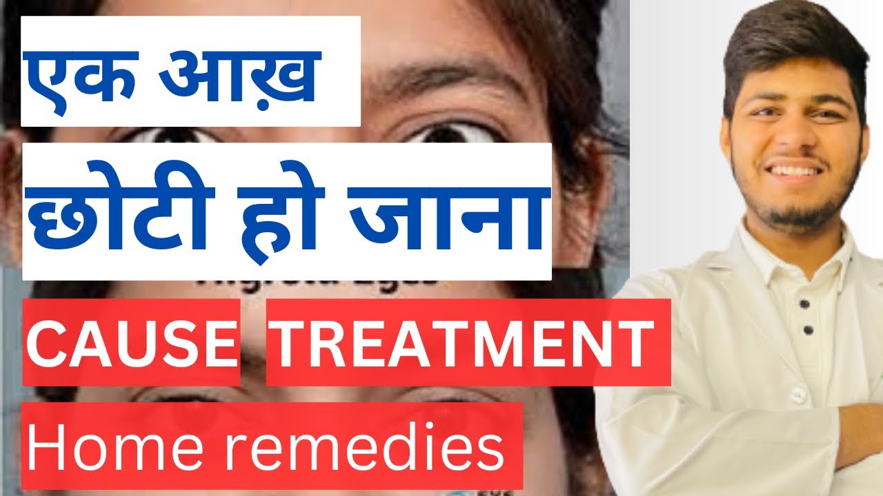 एक आख़ छोटी हो जाना | If one of your eye is smaller Causes ,Treatment ...