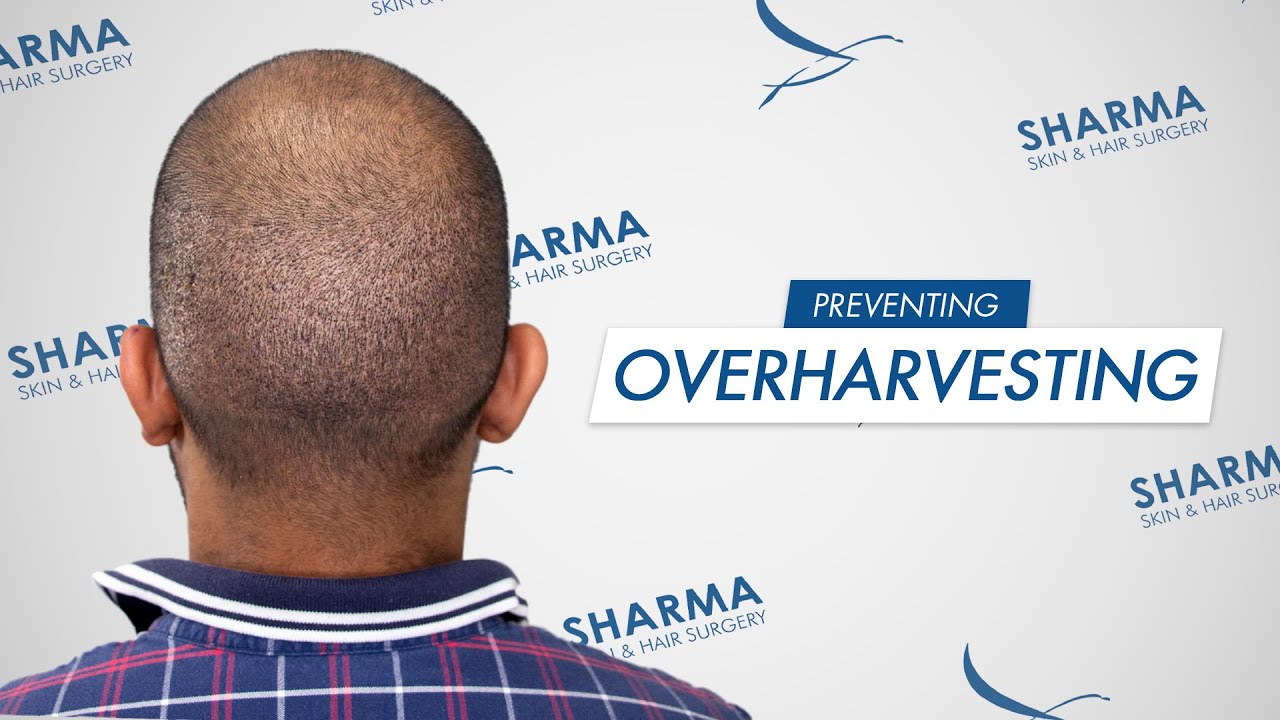 Preventing Overharvesting - YouTube