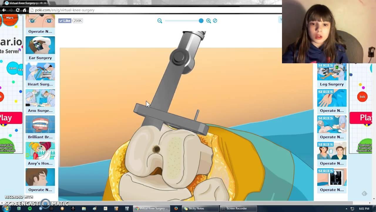 virtual knee surgery - YouTube