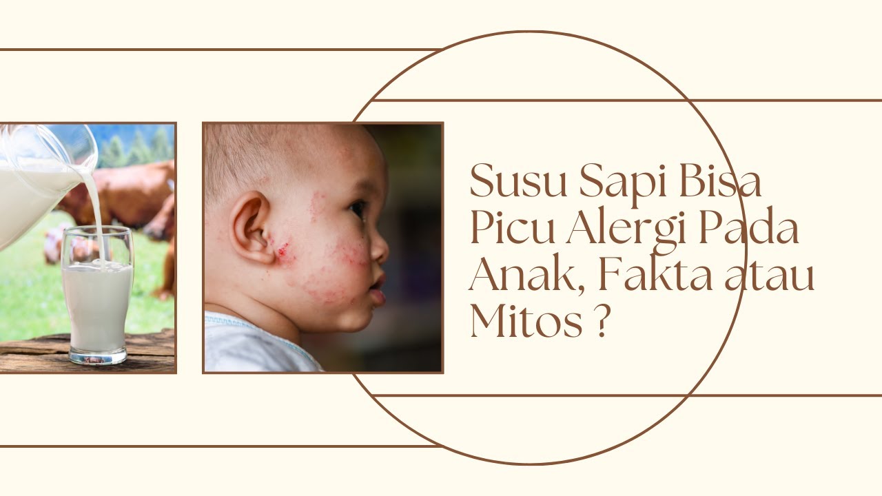 5 Mitos Seputar Alergi Susu Sapi pada Anak #mitos #alergi # ...