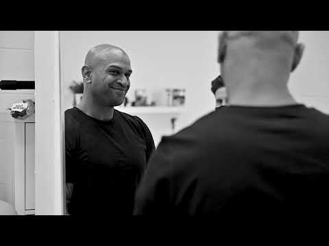 Best Scalp Micropigmentation by Artist Rob James, Ultra Natural SMP ...