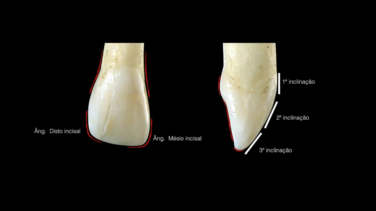 Anatomia e Morfogia Dental - YouTube