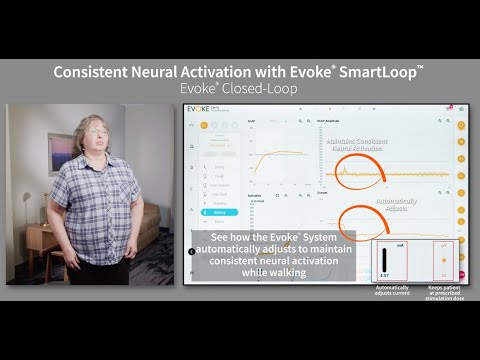 Consistent Neural Activation with Evoke® SmartLoop™ Technology - YouTube