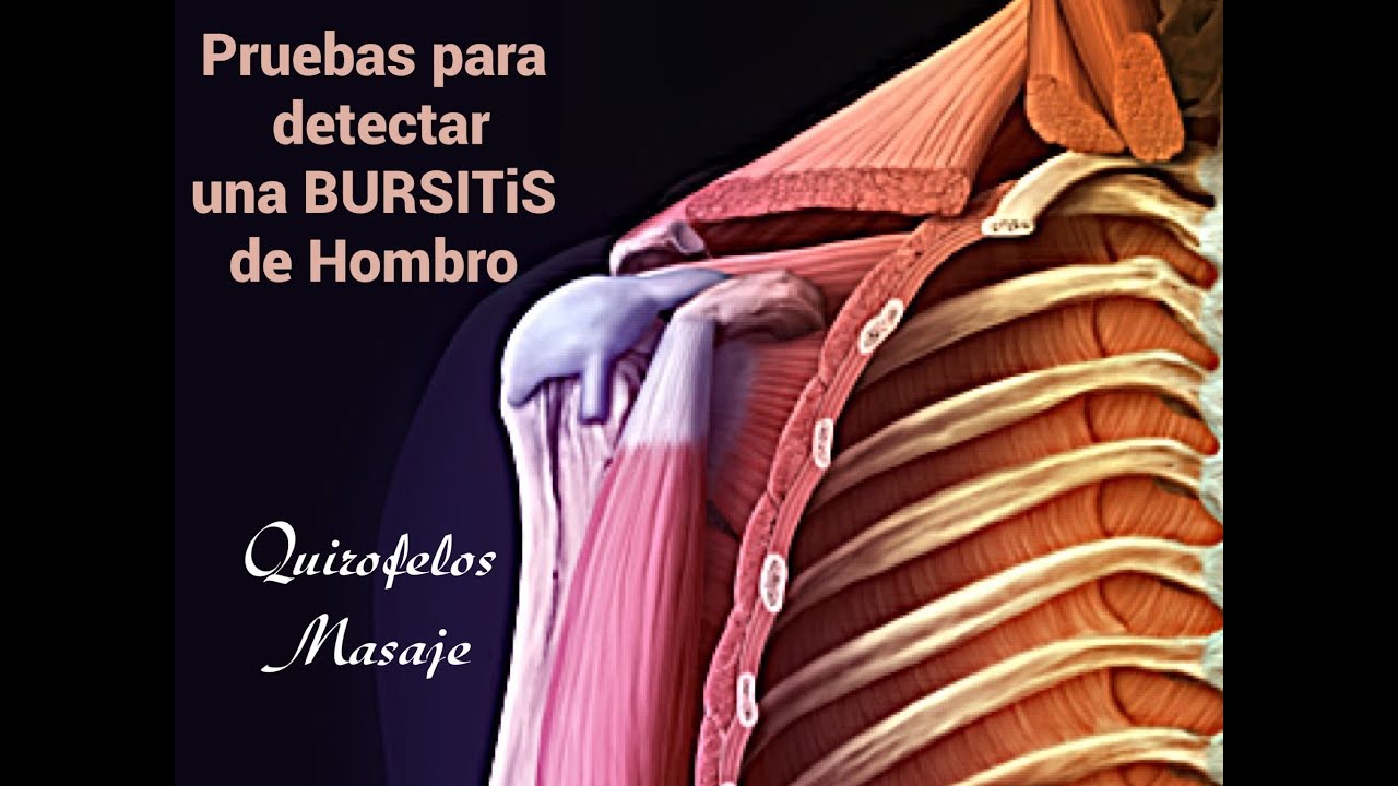PRUEBAS PARA DETECTAR UNA BURSITIS DE HOMBRO - YouTube