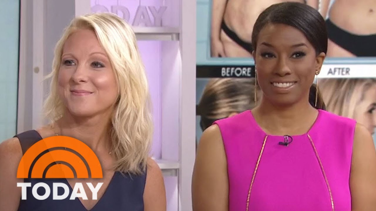 ‘Botched’ Plastic Surgery: Two Women Share Their Stories | TODAY - YouTube